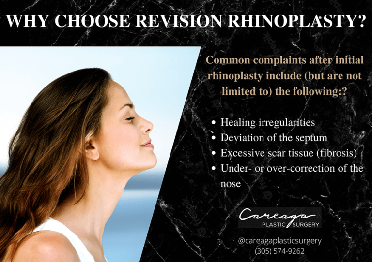 Unhappy With Your Nose Job? Revision Rhinoplasty Can Help | Careaga ...